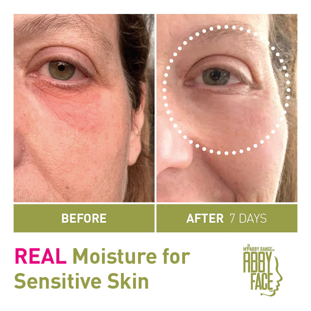 REAL Moisture for Sensitive Skin – AbbyOil